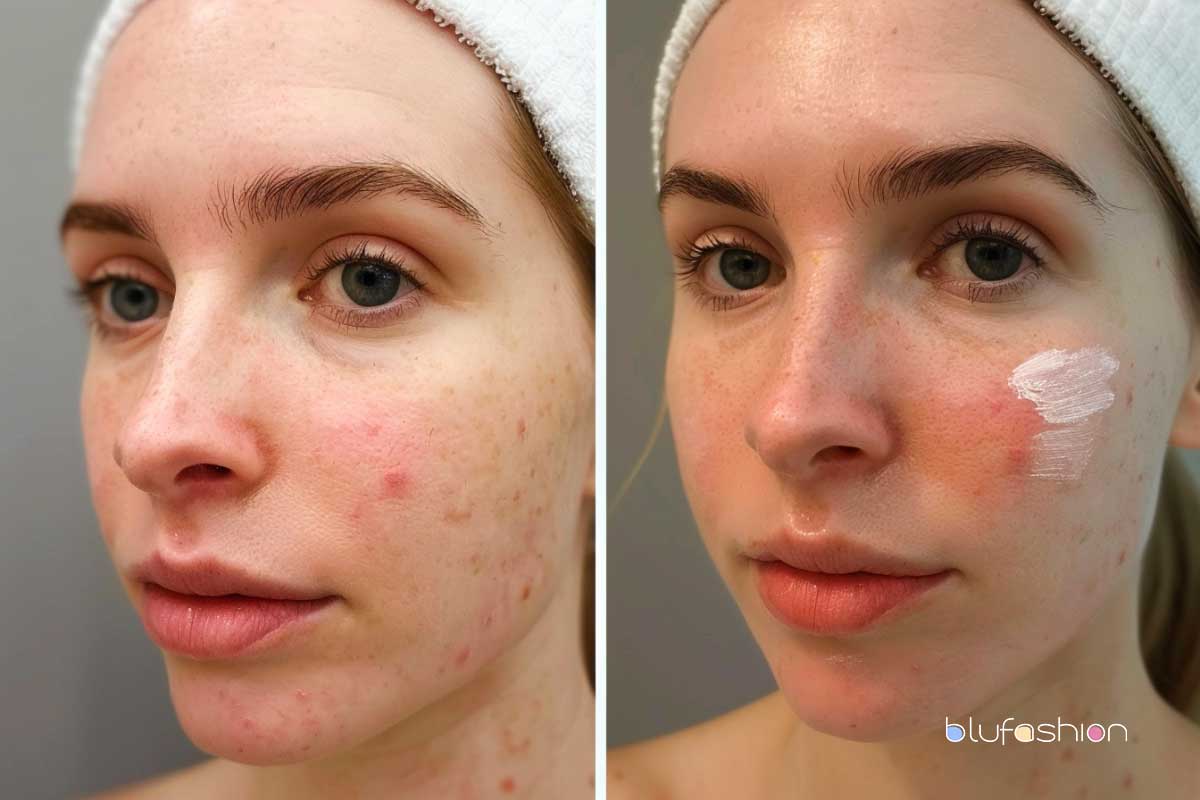 Real Results: Skinvive Before and After Photos Revealed