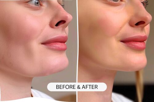 The Truth About Mewing: Does It Really Work or Is It Just Another Fad?